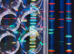 Investors - Molbio Diagnostics