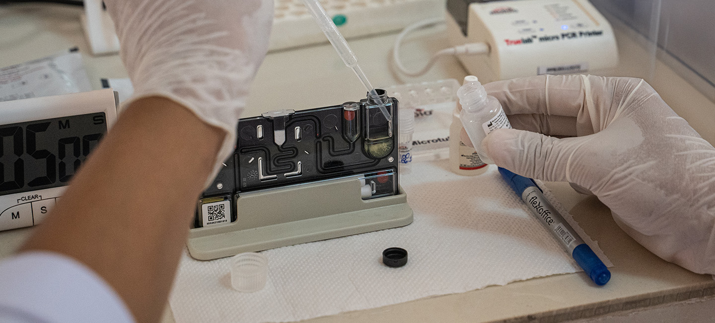 Singh Et Al Chip Based Real Time Rt Pcr Truenat Versus Conventional Real Time Rt Pcr For