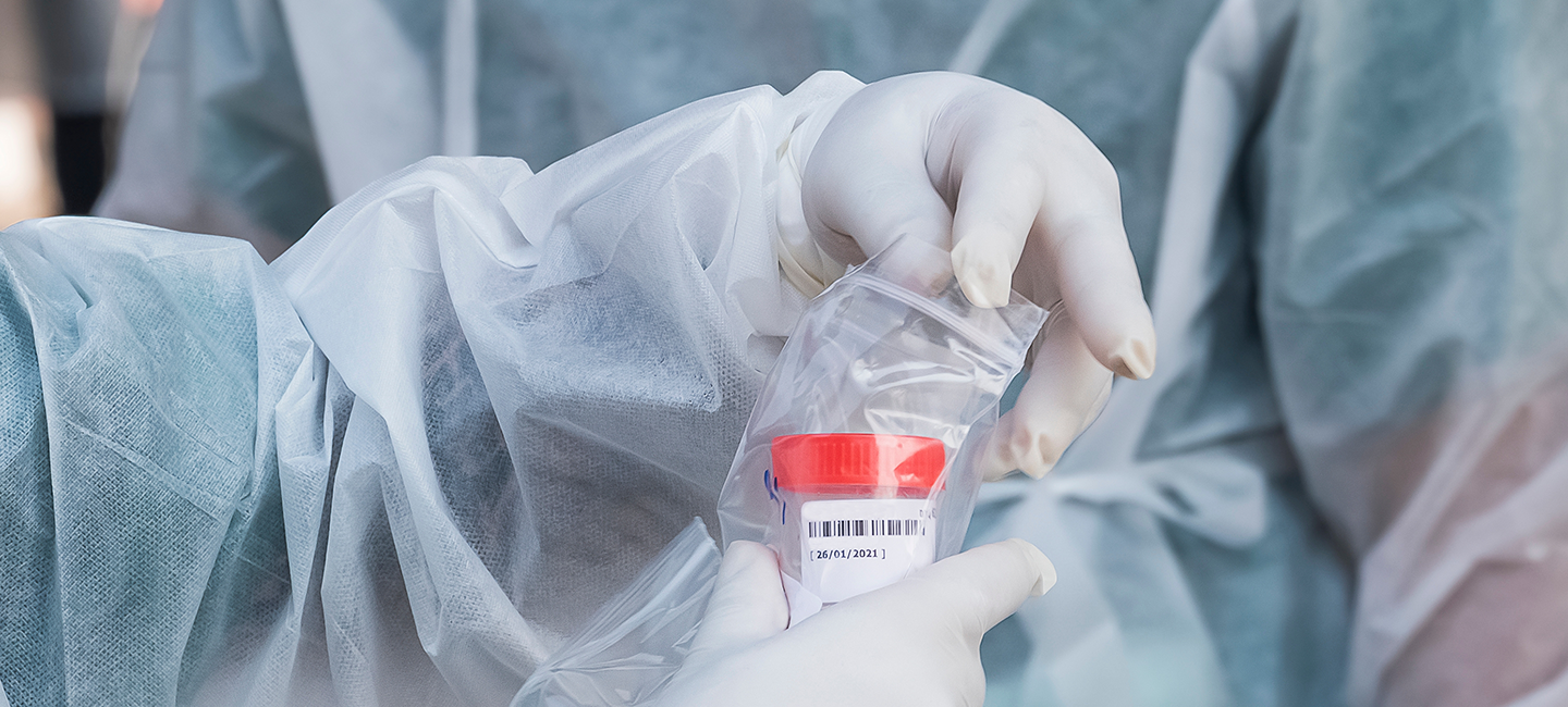 Gomathi et al. Multicentric validation of indigenous molecular test ...