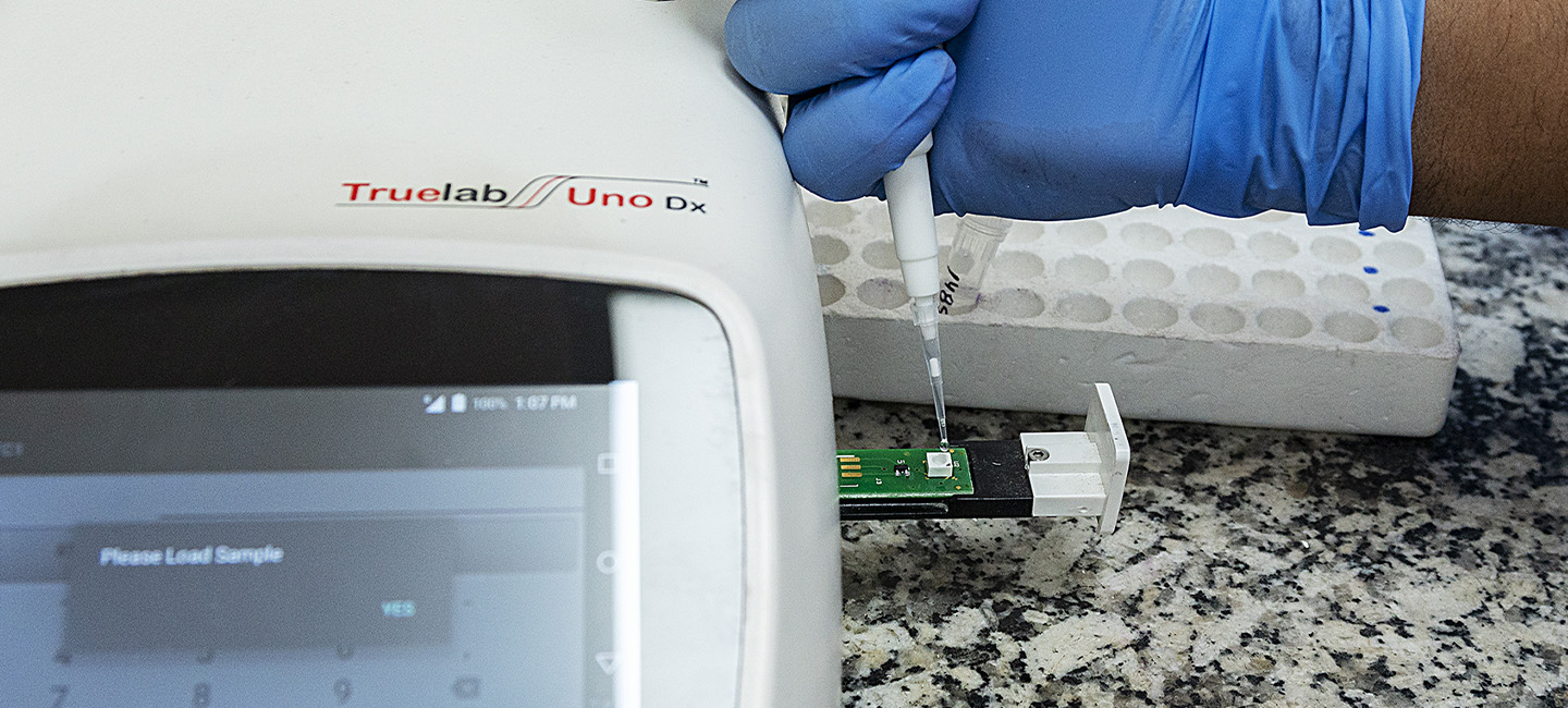 Swarn et al. Usefulness of TrueNat - A Chip-based Real-time PCR Test ...