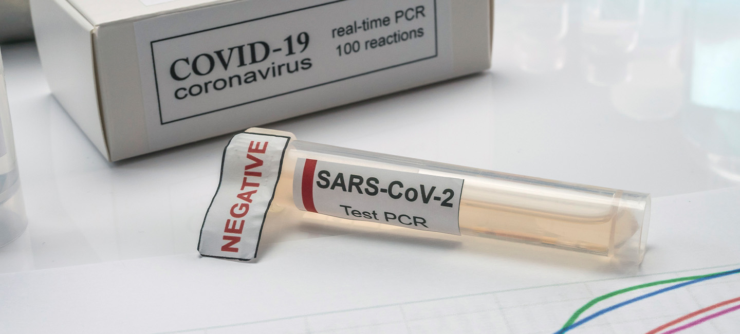 Polu 等人通过基于芯片的实时 PCR 检测（truenat™ beta CoV）在多样本池中检测 SARS CoV-2 的评估 - Molbio Diagnostics