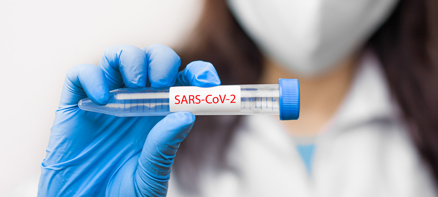 Yengkhom et al. SARS-CoV-2 Positivity using RT-PCR at a Tertiary Care Medical Institute in ...