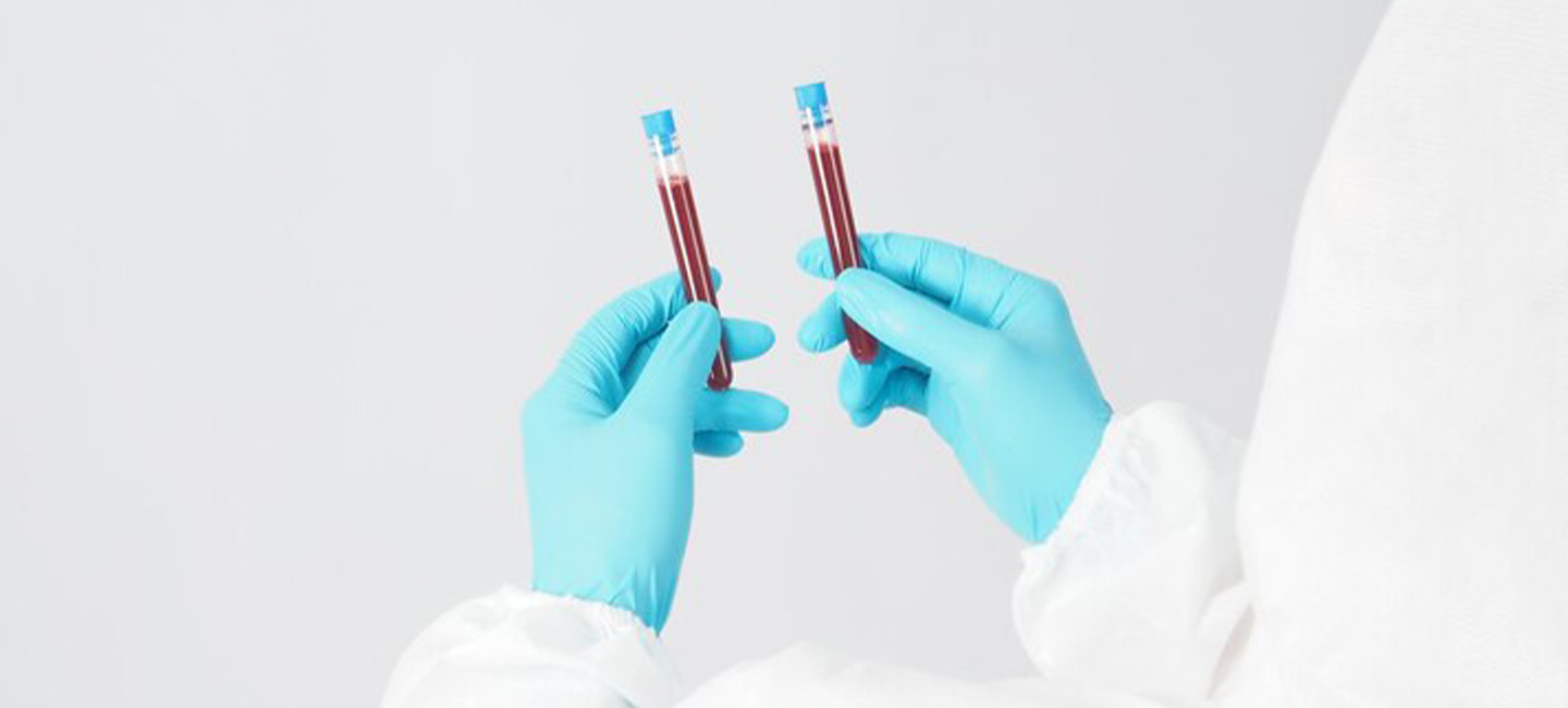 Bouamar Et Al Comparison Of Two Field Deployable Pcr Platforms For Sars Cov 2 And Influenza A