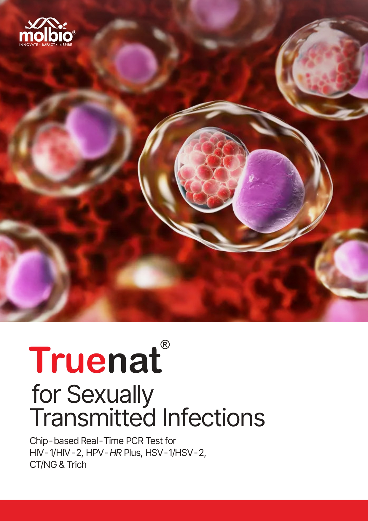 STIs - Molbio Diagnostics